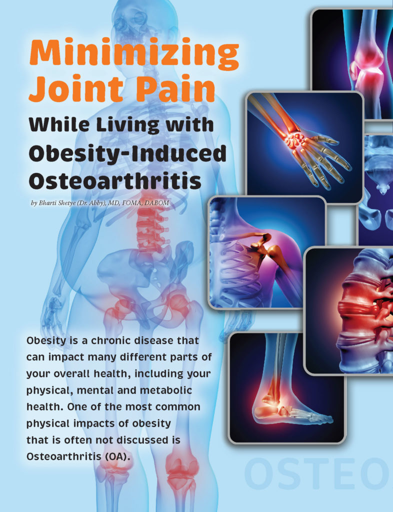 Minimizing Joint Pain While Living with Obesity-Induced Osteoarthritis ...